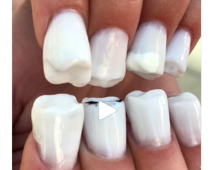 Molar Nails Are a Thing; Please Make It Stop - TheFastFashion.com